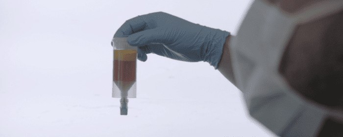 Adipose Tissue-Derived Stem Cells in Regenerative Medicine - Stemedix ...