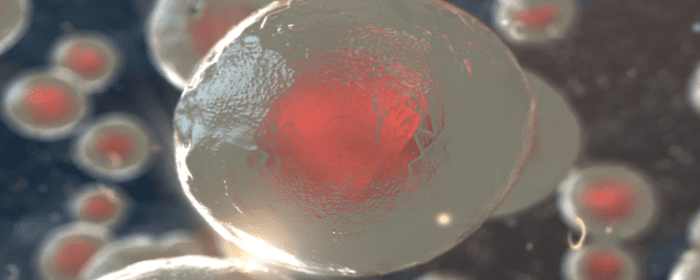 Mesenchymal Stem Cell Treatment for Multiple Sclerosis - Stemedix ...