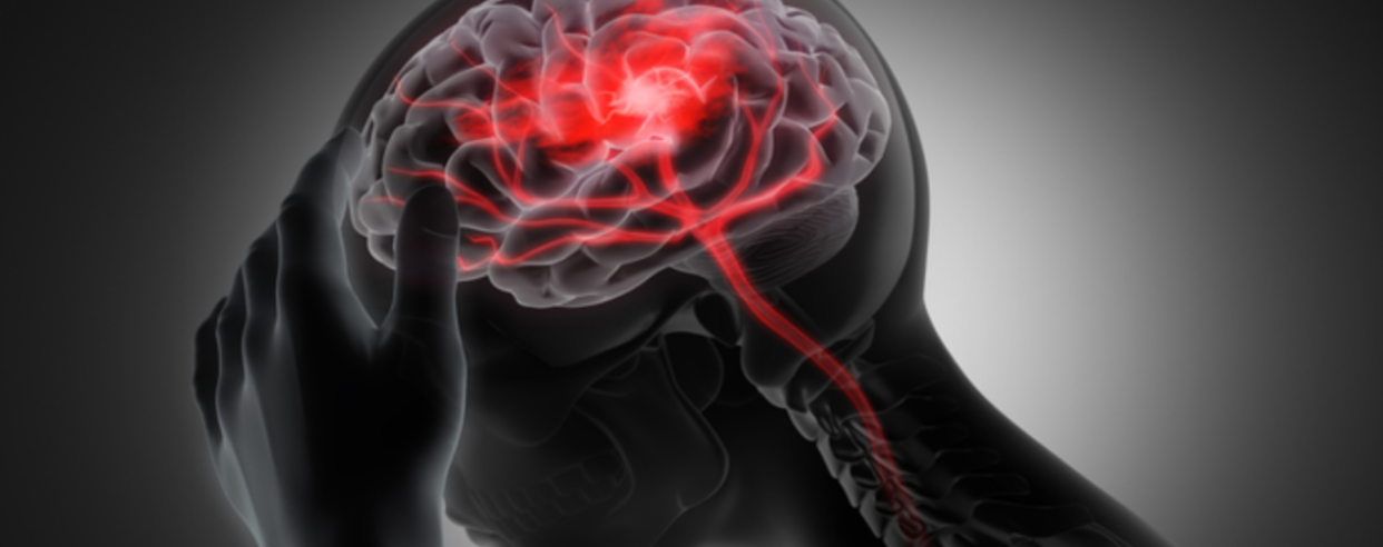 How Does TBI Affect the Brain? | Stemedix | Stem Cell Therapy